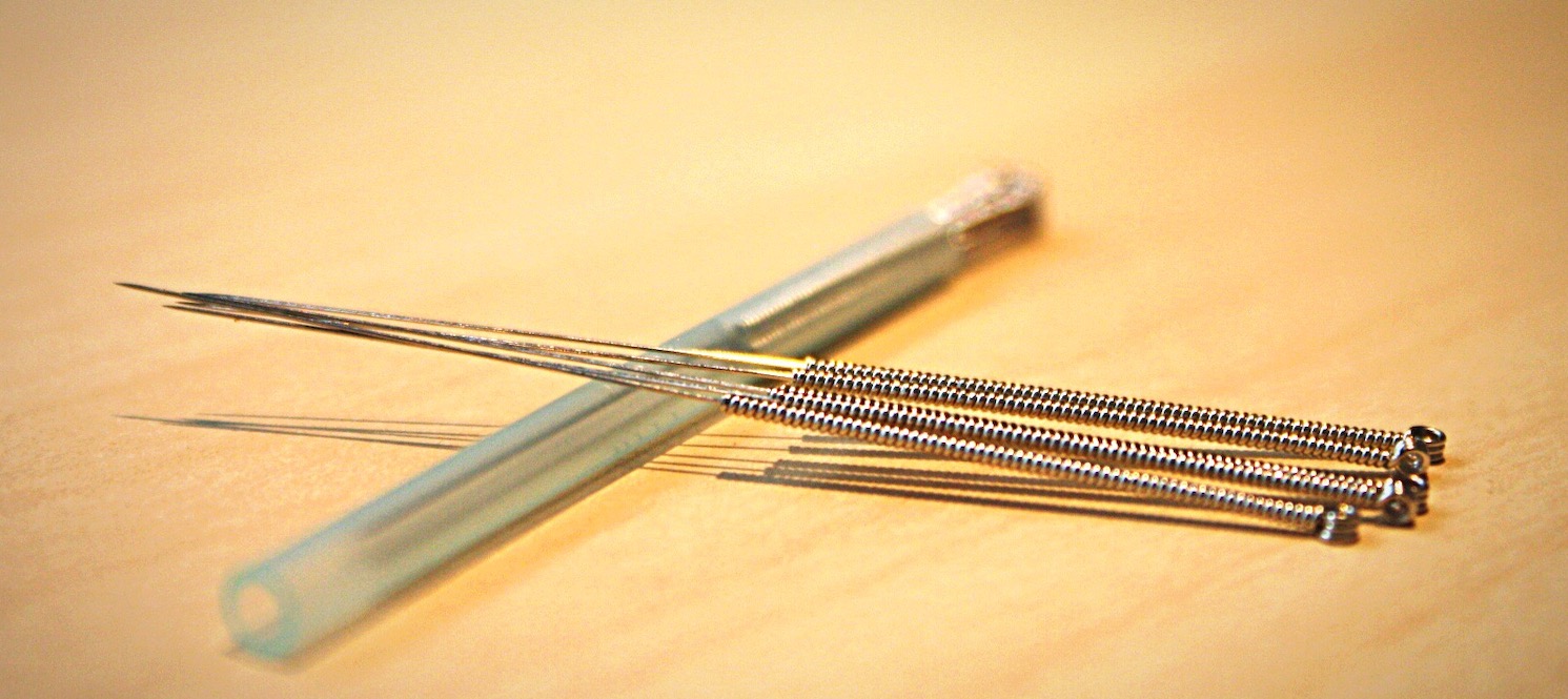 After acupuncture treatment : what to do & what to expect