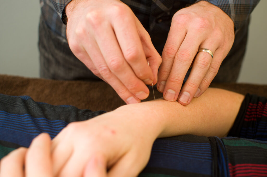 Acupuncture - Watershed Wellness - Astoria
